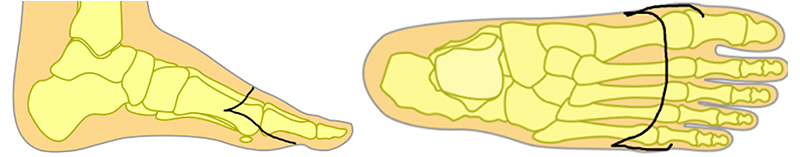 Practice Perfect 751 - Let’s Talk TMA - Technique Tips - Part 2