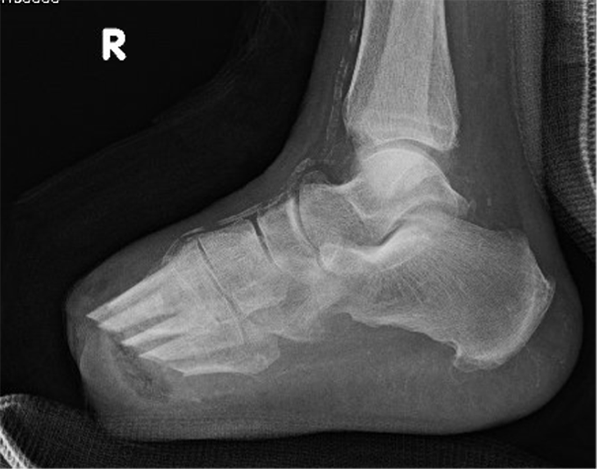 Practice Perfect 751 - Let’s Talk TMA - Technique Tips - Part 2