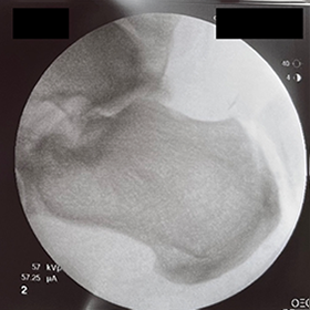 Practice Perfect 782 - An Operating Room Tip ﻿﻿﻿to Get a Much Better ...