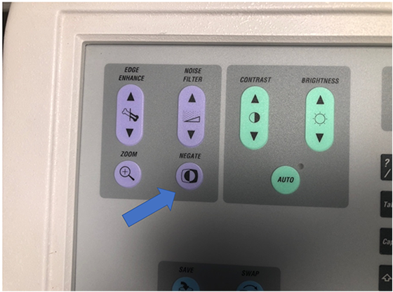 Practice Perfect 782 - An Operating Room Tip ﻿﻿﻿to Get a Much Better ...